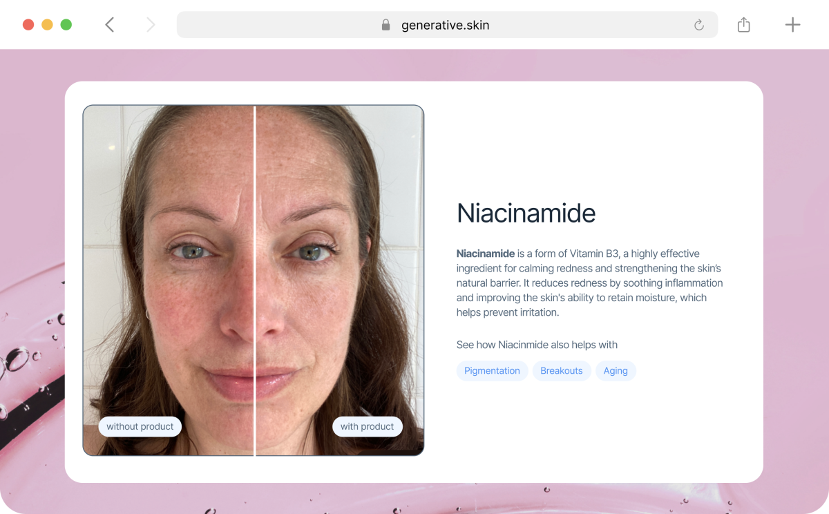SkinGPT Uses AI to Simulate the Long-Term Results of Skin-Care Products ...